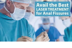 Avail the Best Laser Treatment for Anal Fissures - Laser Piles Clinic