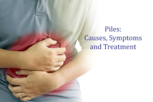 What is Piles Cause, Symptoms and Treatment – Laser piles Clinic